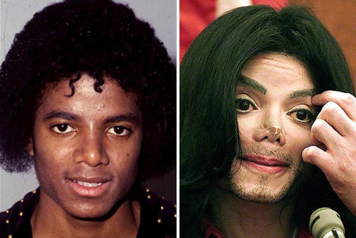 Cirugías Plásticas Celebridades 16 De Las Cirugías Plásticas Más Caras De Las Celebridades