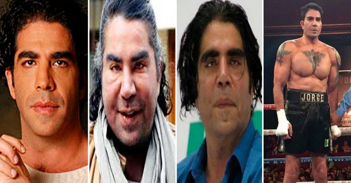 Cirugías, Celebridades, Hollywood: Famosos que gastaron mucho dinero en ...