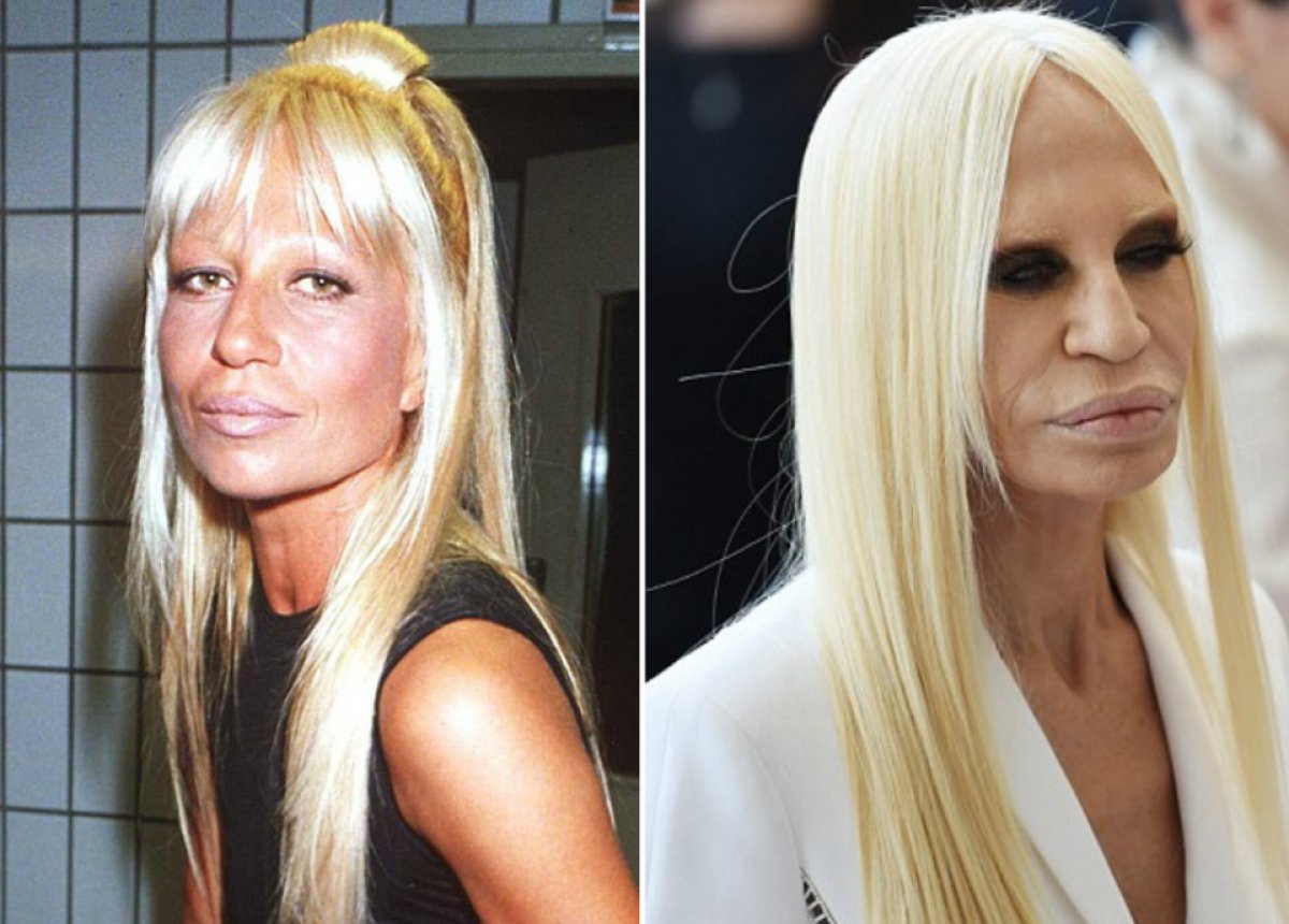 Celebridades de Hollywood que se operaron la cara | Fotogalería | Radio ...