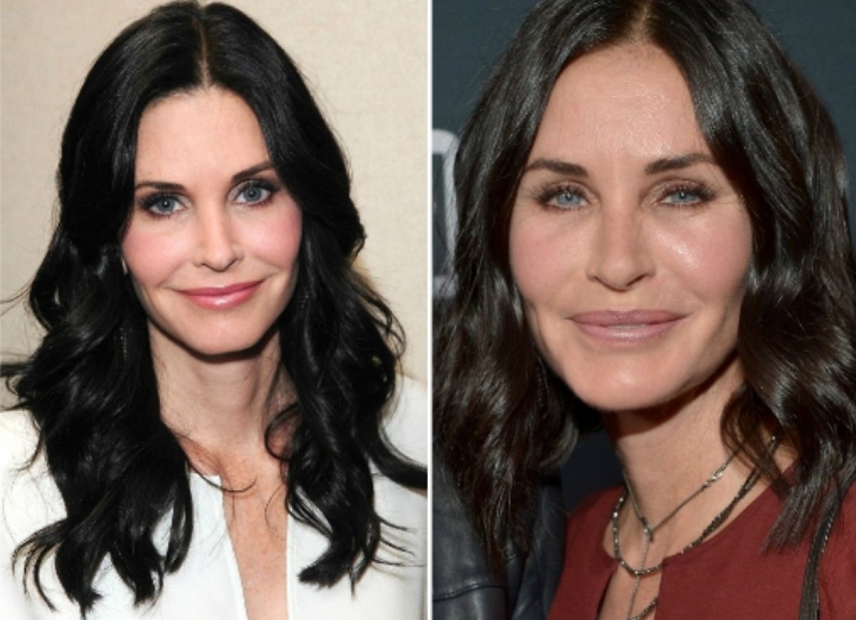 Celebridades de Hollywood que se operaron la cara | Fotogalería | Radio ...