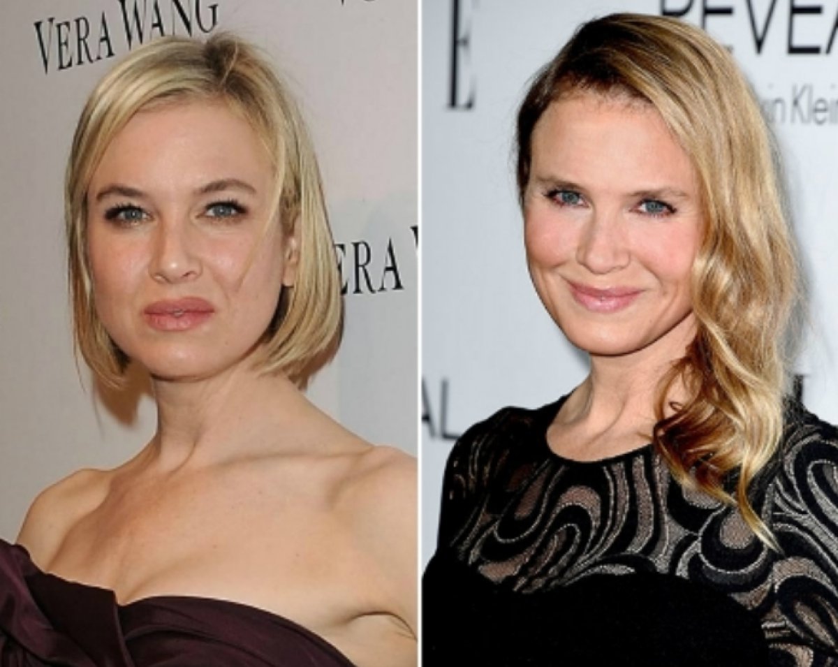 Celebridades de Hollywood que se operaron la cara | Fotogalería | Radio ...