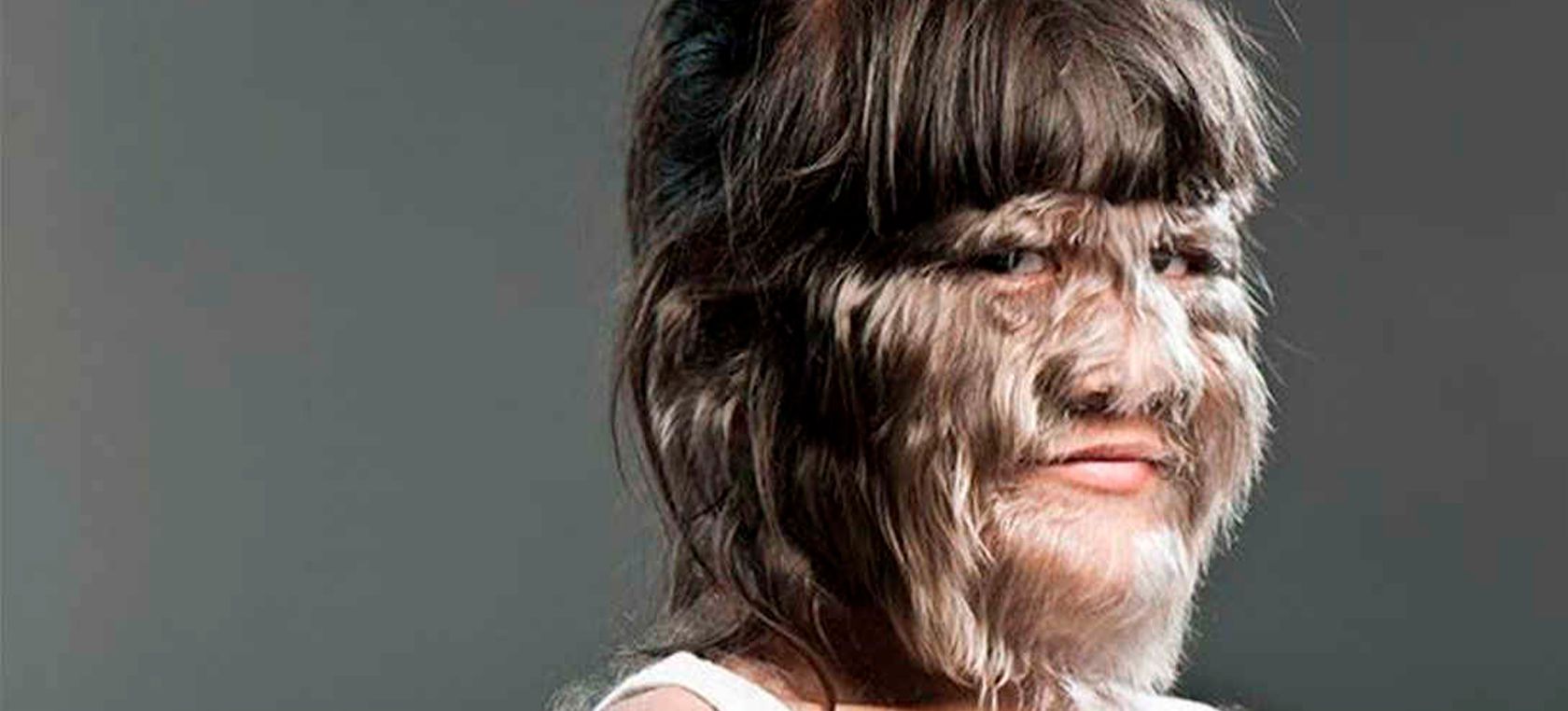 La niña con más pelo del mundo decidió afeitarse tras conocer el amor ...