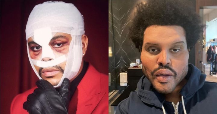 Éste es el motivo de la nueva apariencia de The Weeknd | Música | LOS40 ...